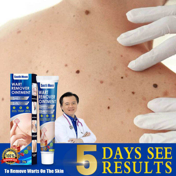 warts remover original watson removal skin tags and warts remover mole ...