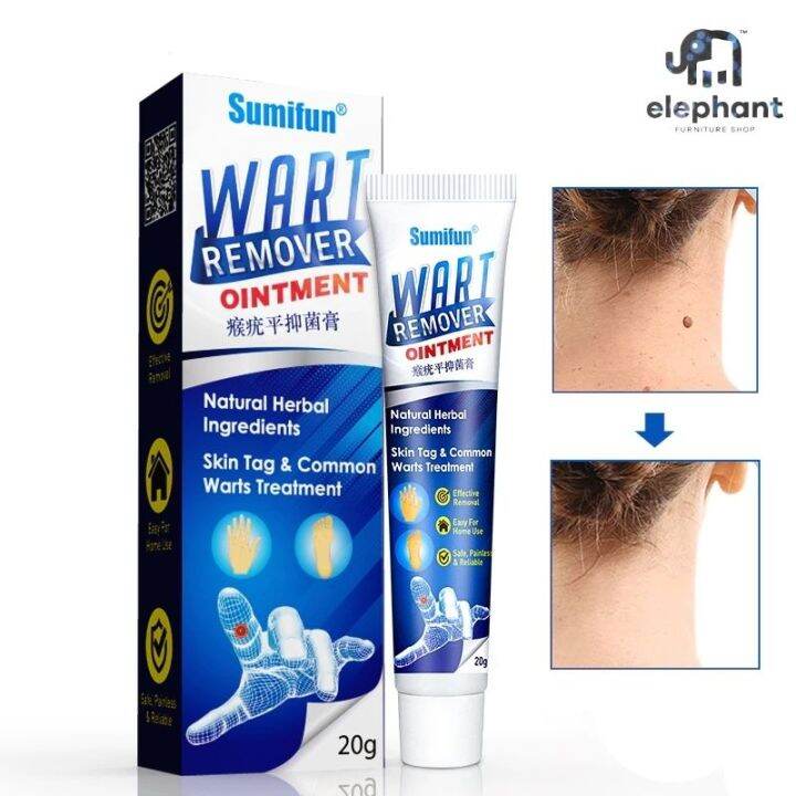 Elephant.Wart Remover Magic Ointment Wart Treatment Cream Skin Tag ...