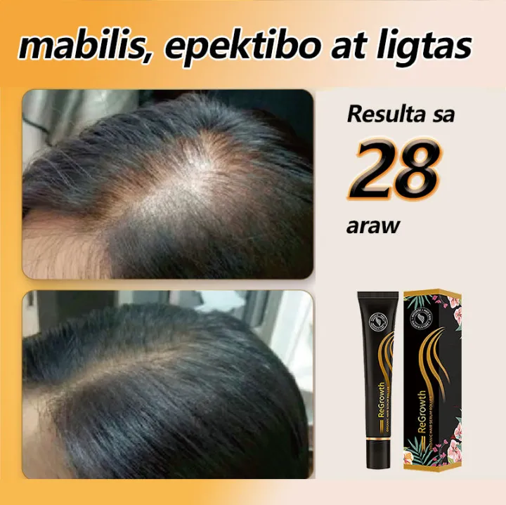 Support COD Hair Grower For men original hair treatment hair growth ...
