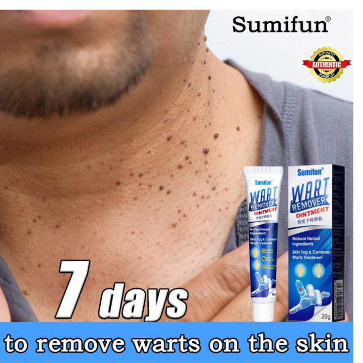Wart Removal Ointment Wart Treatment Cream Neck Skin Tag Armpit Flat ...