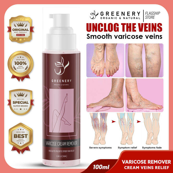 Greenery varicose veins remover effective original cream anti varicose ...