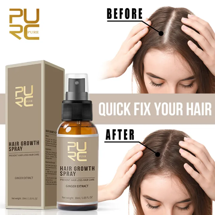 Purc Ginger Hair Growth Spray Hair Treatment Hair Loss Treatment Hair