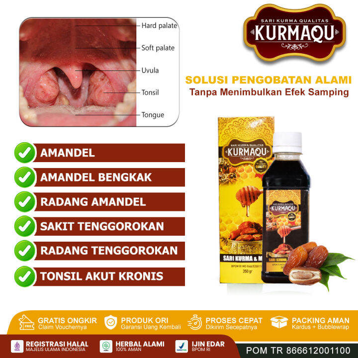 Obat Amandel Untuk Anak Dewasa, Sakit Tenggorokan, Sakit Saat Menelan ...