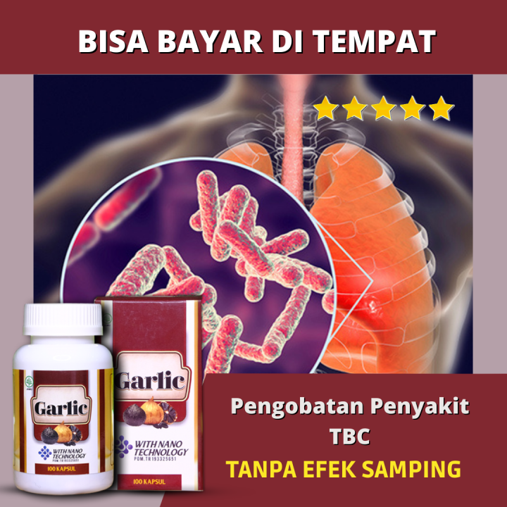 BLACK GARLIC - OBAT Penyakit TBC / Tuberkulosis - Batuk Darah, Batuk ...