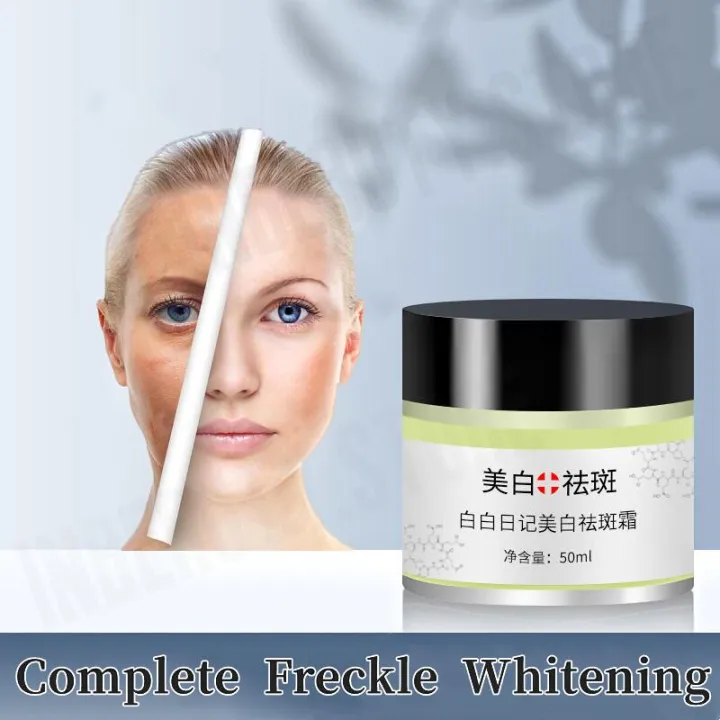 Whitening Freckle Cream Remove Melasma Cream Dark Spots Melanin Remover Brighten Skin ...
