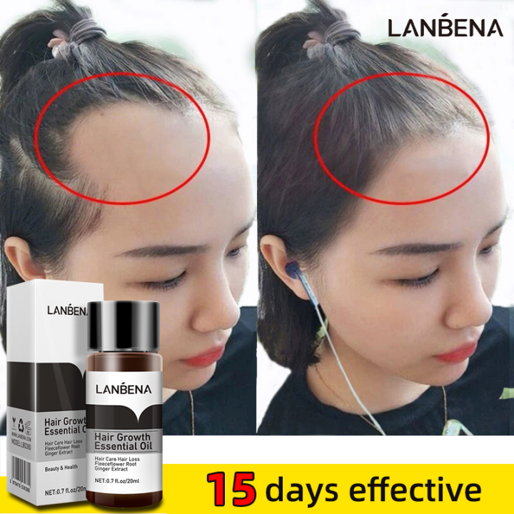 Lanbena Hair Growth Essential Oil Hair Loss Treatment Prevent Baldness