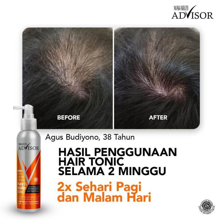 Makarizo Advisor Hair & Scalp Tonic 240mL Perawatan Rambut Rontok dan ...
