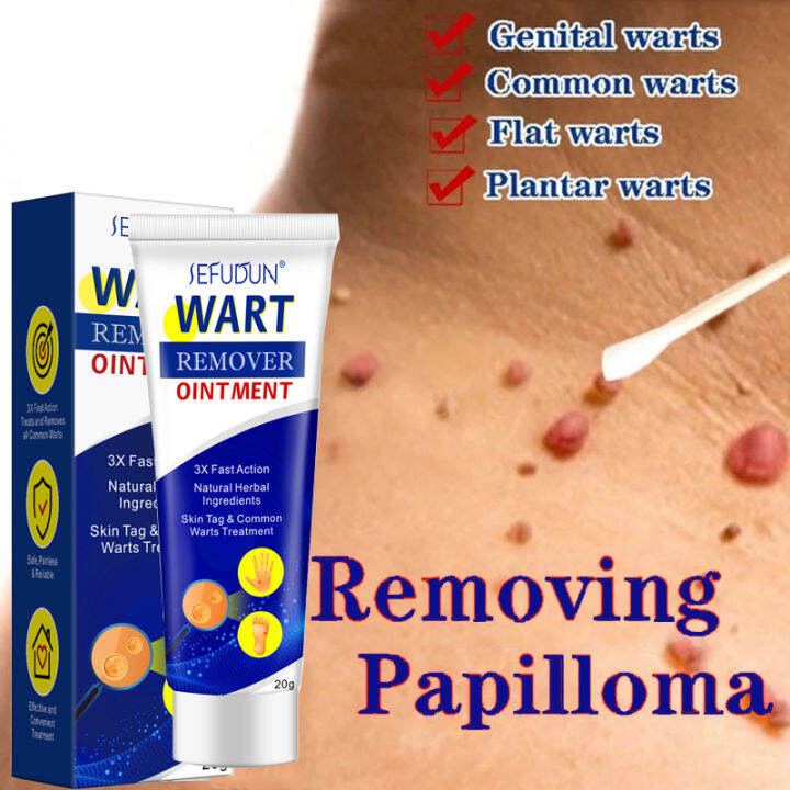 Warts Remover Original Cream 20g Warts Magic Remover Wart Ointment ...