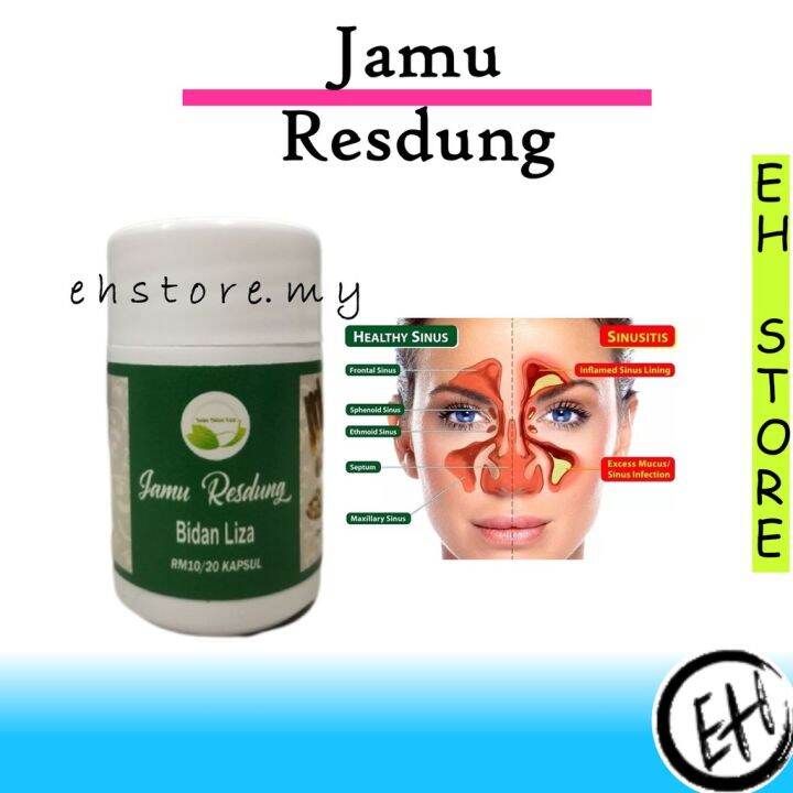 J.a.m.u resdung + / Penawar resdung / Gatal muka / gatal hidung | Lazada