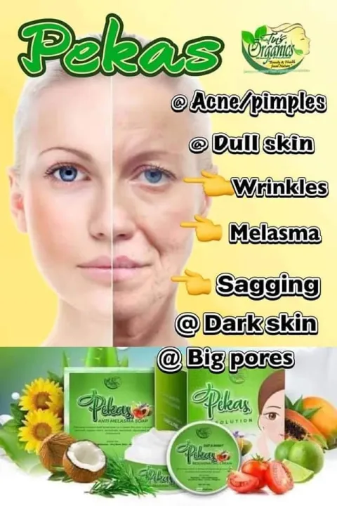 Tin's Organic Pekas & Melasma Solution | Lazada PH