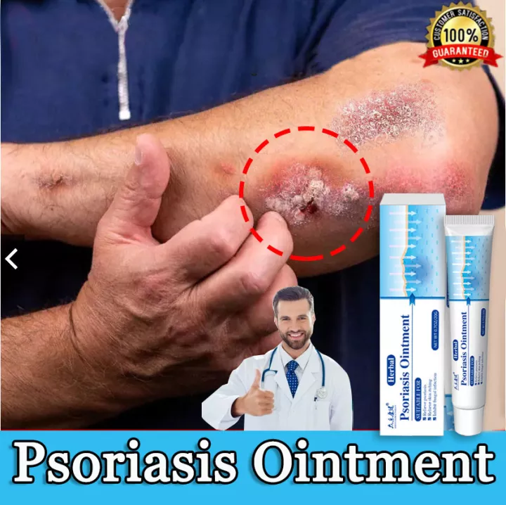 100% Effective Psoriasis Ointment Psoriasis Cream Eczema Treatment Skin ...