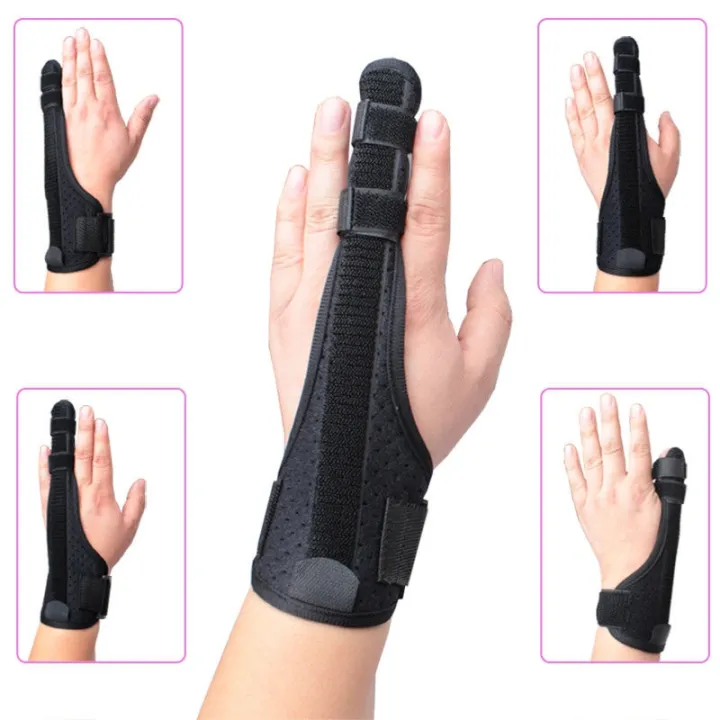 Finger fracture fixed with a sprain orthotics dislocation protection of ...