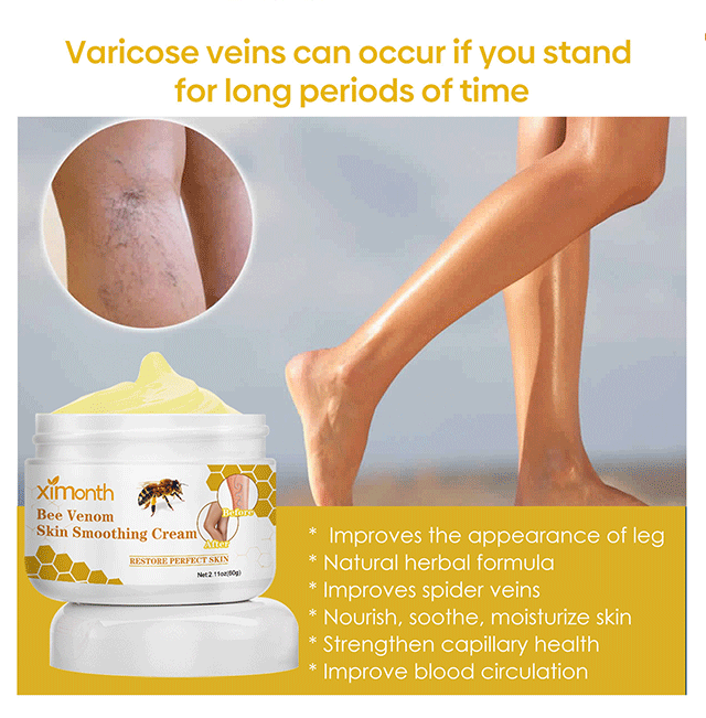H Bee Venom Vein Repair Cream Bee Venom Vein Repair Cream Bee Venom ...
