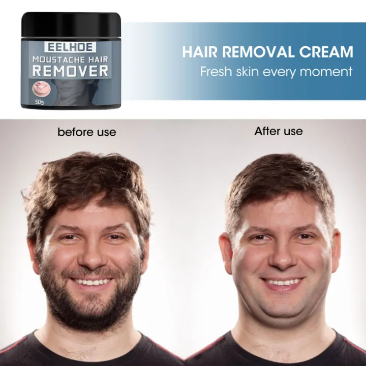 Permanent Hair Removal Cream Mens Facial Beard And Beard Removal Cream