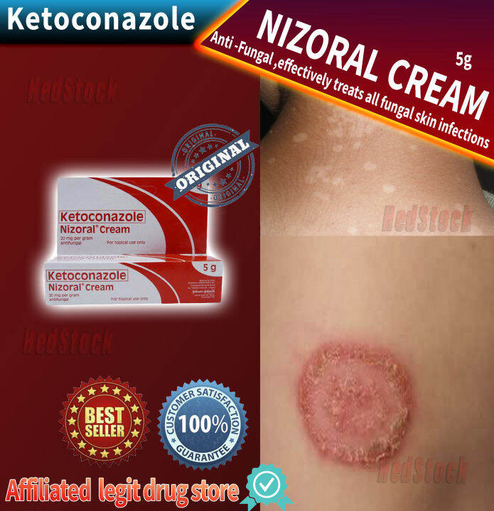 Cream treats all fungal skin infections/katikati Galis/Hadhad/alipunga ...