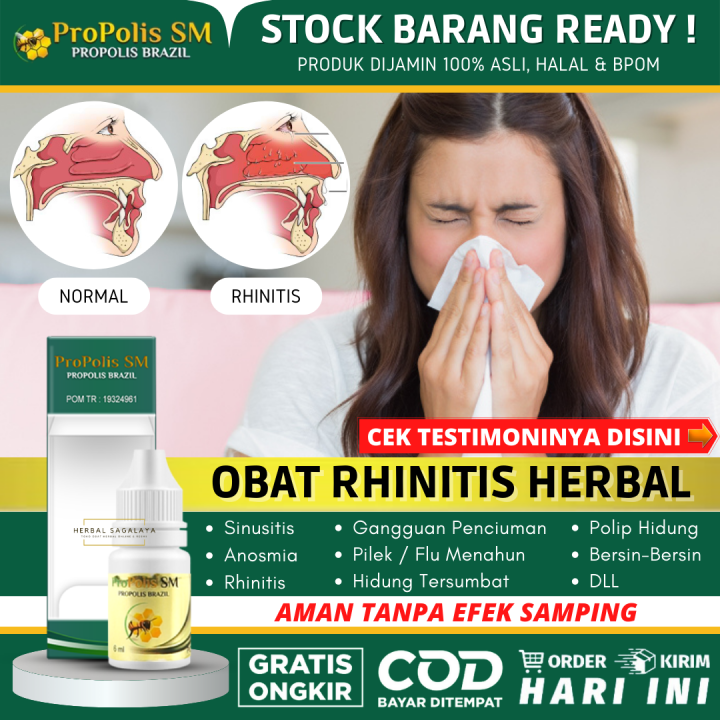 Obat Rhinitis Alami 100% ASLI - Obat Penyakit Rhinitis Tradisional, Obat Rinitis Kronis & Akut ...