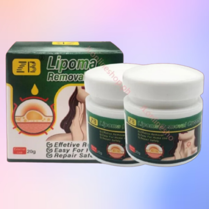 Zb Lipoma Removal Cream 20g Fast Absorption Lipoma Fat Lump Bulge ...