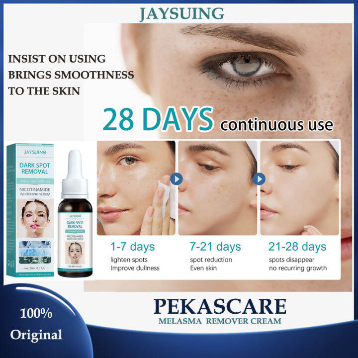 PEKAS REMOVER CREAM / MELASMA CREAM Acne Melasma Pekas Care Dark Spots ...