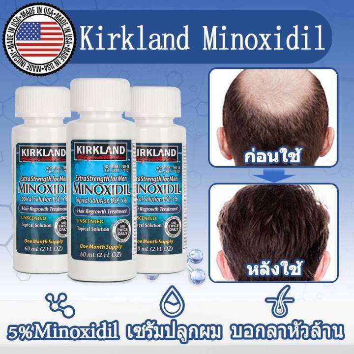 Kirkland Signature Mi noxidil 5% นำเข้าจากอเมริกา เซรั่มปลูกผม น้ำยา ...