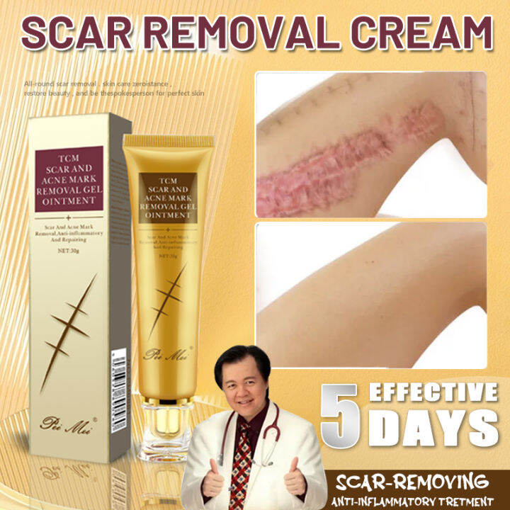 scars remover for old scars fix scar removal original scar gel by doc ...