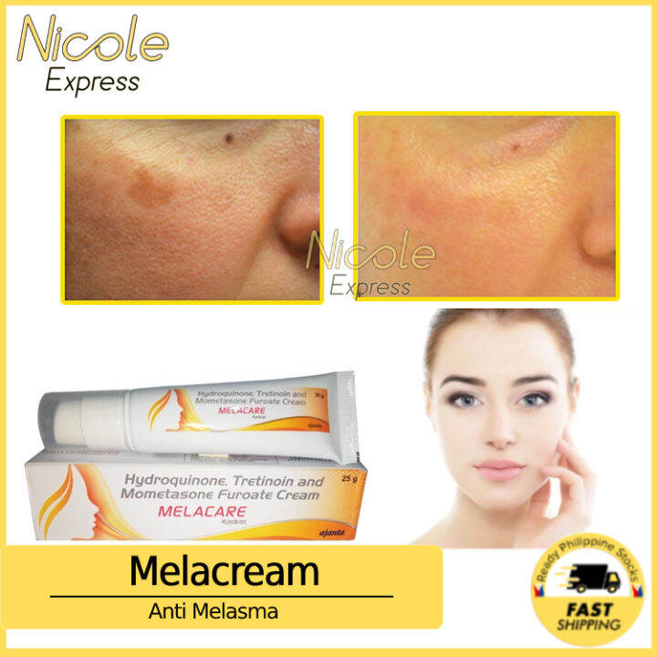 Melacare Cream 25g for Melasma Pekas Remover Pekas Eraser, Skin ...