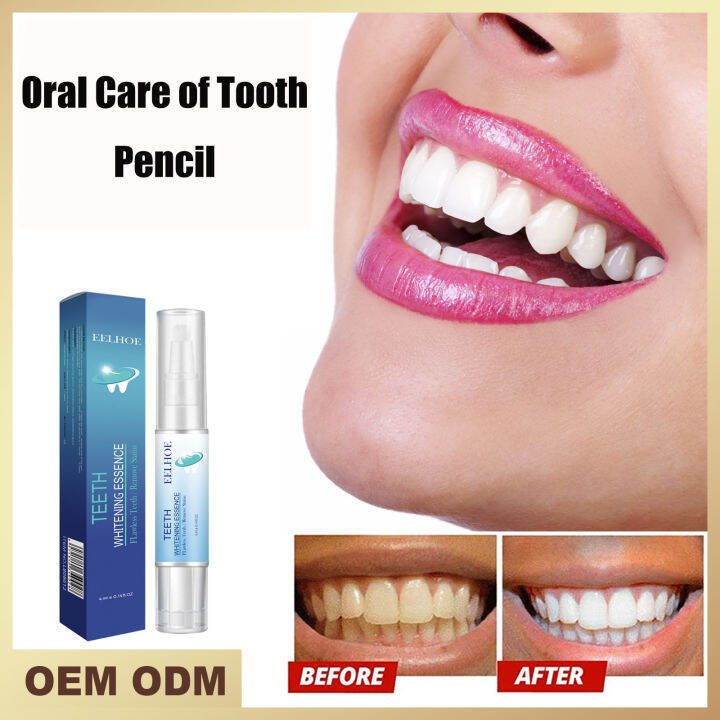 Teeth Whitening Pen Repair Remove Yellow Melanin Plaque Tooth Cleaning ...