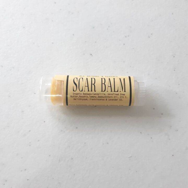 Scar Balm - All Natural & Kidsafe | Lazada PH