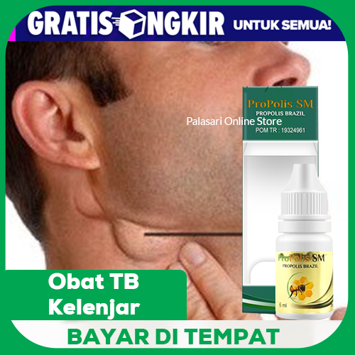 Obat tbc kelenjar, TB Kelenjar, TBC Kelenjar Getah Bening, TB Kelenjar ...