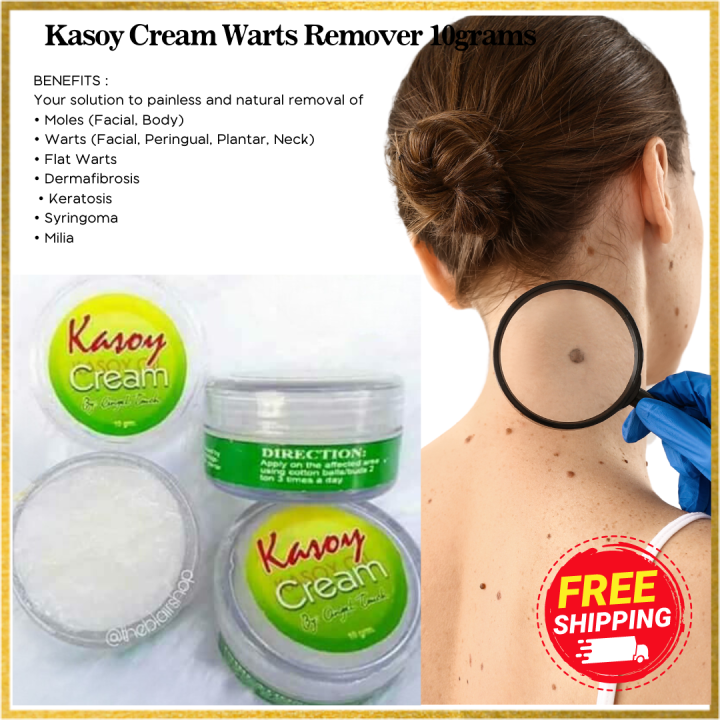 Kasoy oil warts remover legit, kasoy cream original a premuim kasoy ...