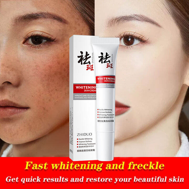 Dark Spot Corrector Cream Whitening Freckle Cream Powerful Removing Melasma Melanin Dark Spots ...