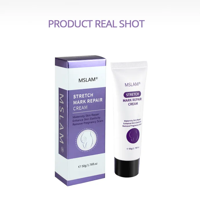 stretch mark remover original Stretch Marks Remover Cream Maternity ...