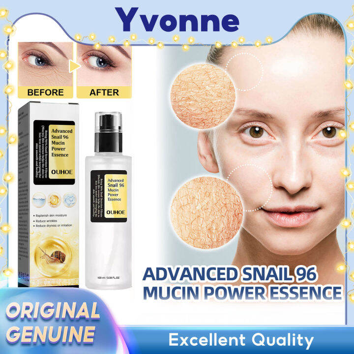 【Hot Sale】OUHOE Advanced Snail 96 Mucin Power Essence Snail Secretion Filtrate For Anti-Aging ...