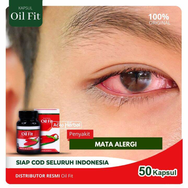 Obat Mata Gatal, Alergi Mata, Obat Penyakit Konjungtivitis, Alergi ...
