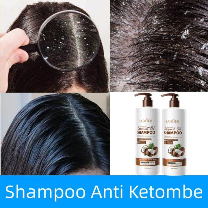 Shampo Sampo Anti Ketombe Dan Gatal Shampoo Anti Ketombe Sampo Penghilang Ketombe Pengobatan ...
