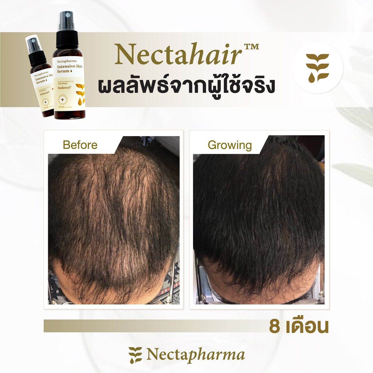 เซรั่มปลูกผม Intensive Hair Serum 50 ml. ไบโอติน ผมร่วง ผมบาง บำรุงผม หนาดกดำ Nectapharma ...