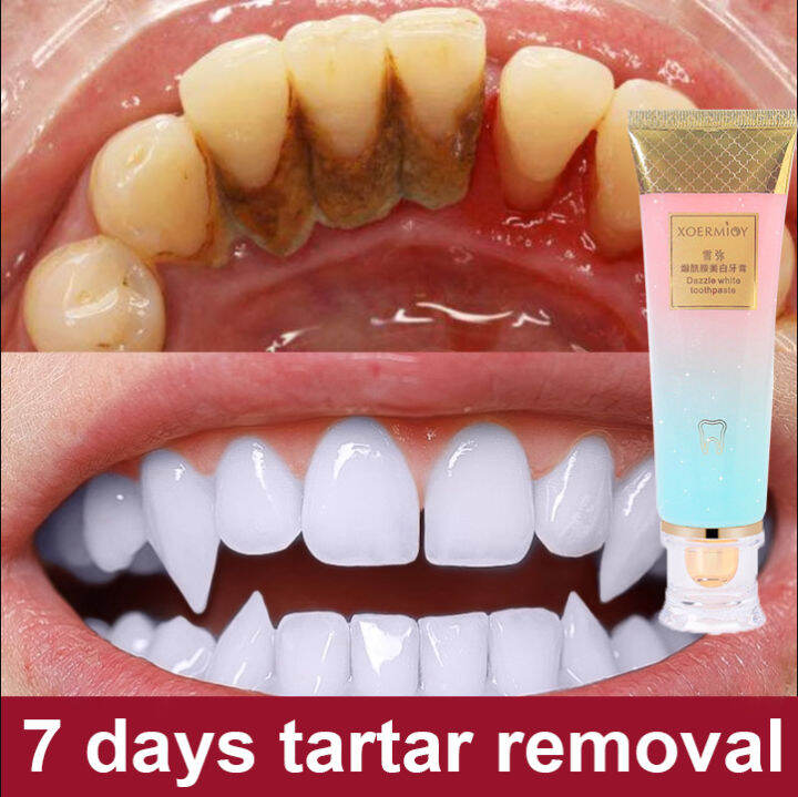 *ORIGINAL READY STOCK*Ubat Gigi Niacinamide Whitening Toothpaste 100g ...