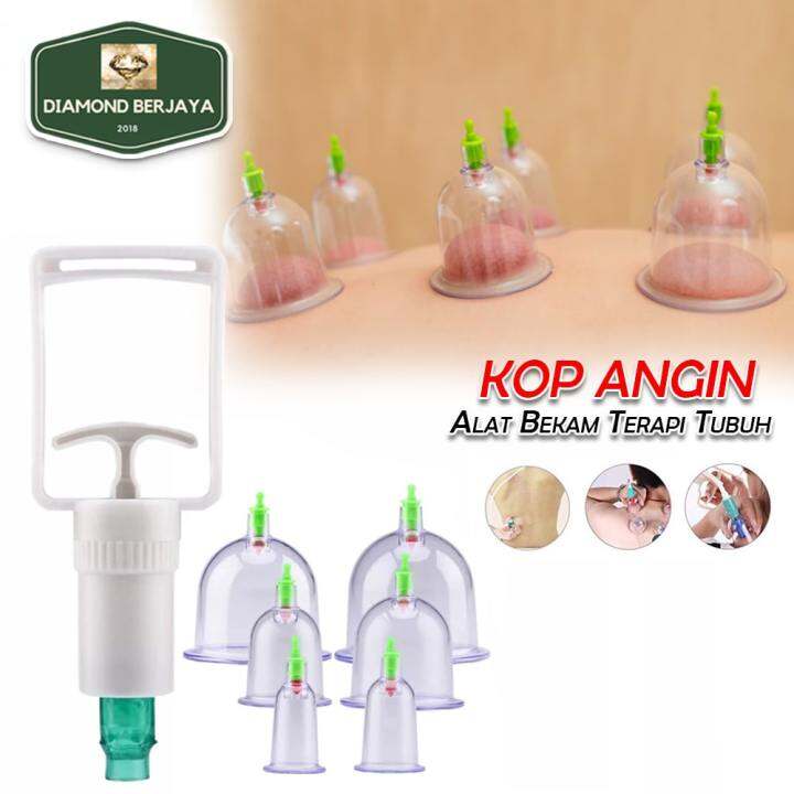 Alat Bekam Kop Angin Kongsui Isi 6 Cup Untuk Menyembuhkan Berbagai Penyakit - Kop Terapi ...