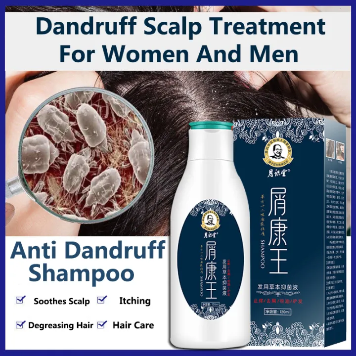 Idun Anti Dandruff Shampoo for Women Dandruff and Scalp Treatment Fast ...