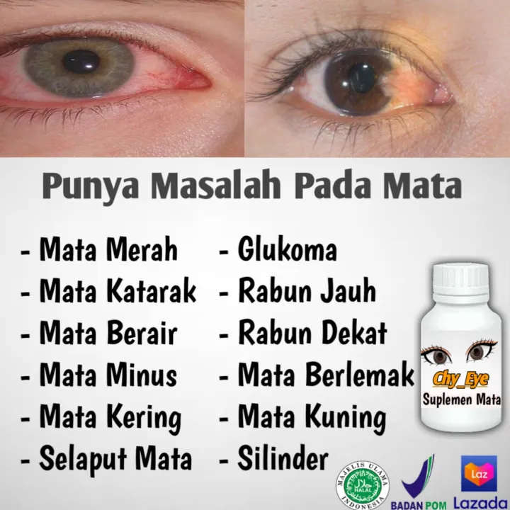 Paket 60 Kapsul - Obat Mata Katarak Mata Buram Mata Rabun Jarak Jauh ...