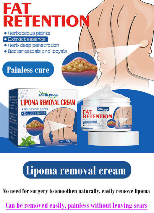 Vivinatural Lipoma removal cream for relieving fat lumps, hard lumps ...
