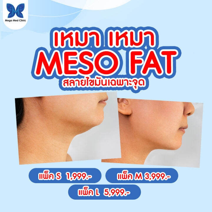 [E-Voucher] Mega Med Clinic แพ็คแกจ Meso Fat สลายไขมัน | Lazada.co.th