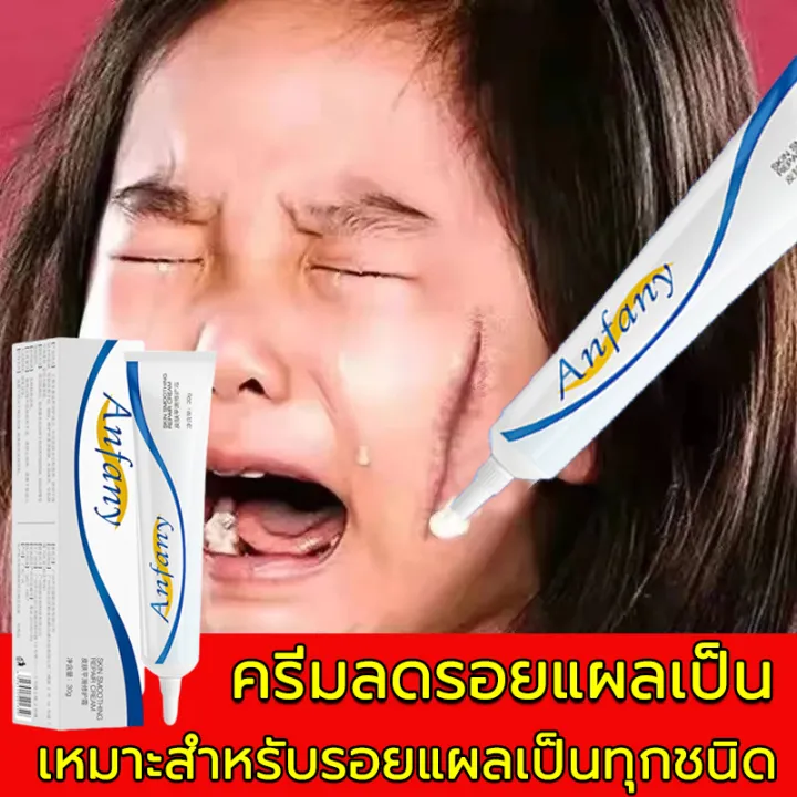 (ส่งจากไทย)ครีมรอยแผลเป็นของแท้100% Anfany 30g เจลทารอยแผลเป้น ครีมลดรอยแผลเป็น เหมาะสำหรับรอย ...