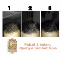 Dokter Botak Bioherbal (Paket Shampo dan Tonik) Atasi kebotakan dan ...