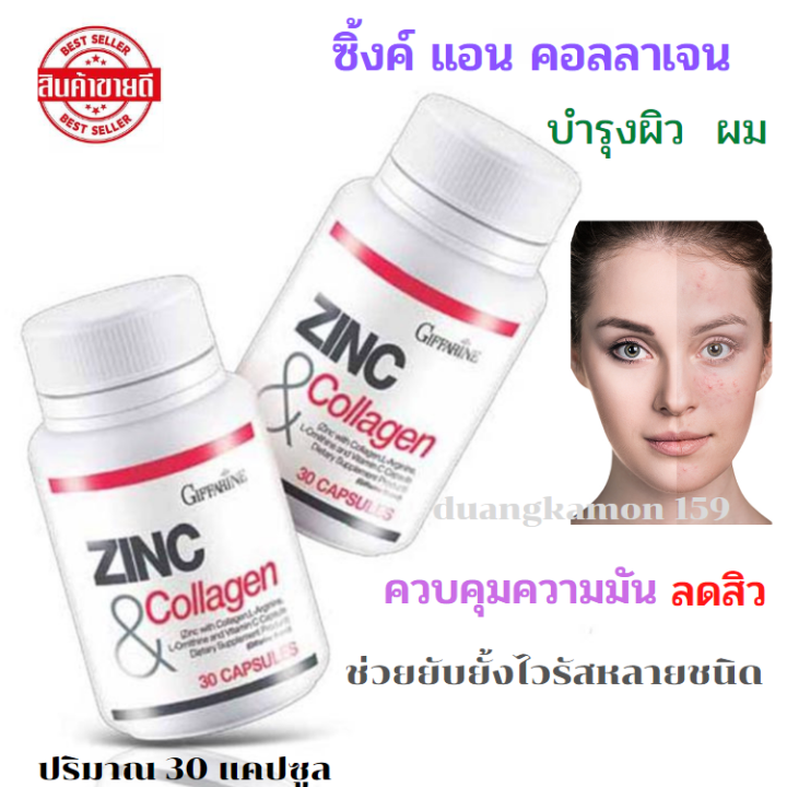 ซิ้งค์ แอน คอลลาเจน อาหารเสริมบำรุงผิว ควบคุมความมัน ลดสิว ผู้ที่มีบุตร ...