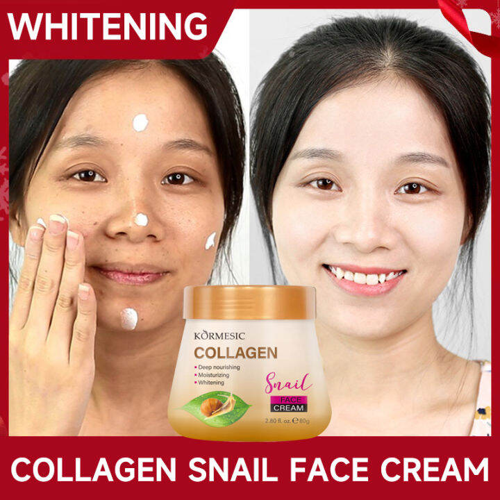 Collagen Snail Face Cream 80g Whitening Remove Freckle Deep Nourishing ...