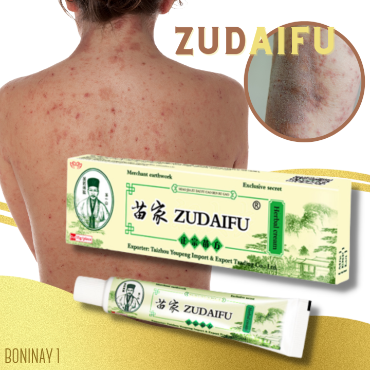TRENDING 15G Zudaifu Chinese Herbal Skin Psoriasis Cream Dermatitis ...