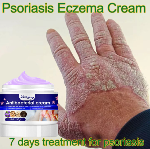 BEST SELLING!Antibacterial Cream 30g Skin Rash Cream Skin Herbal ...