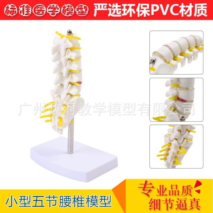 Five lumbar intervertebral disc herniation model spine model miniature ...