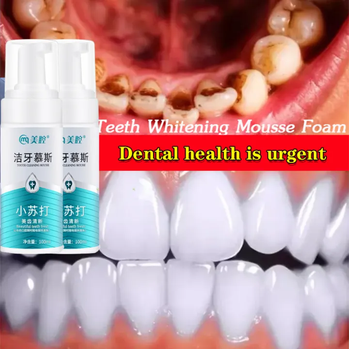 Fast Effective 100g Original Teeth Whitening Mousse Toothpaste ...