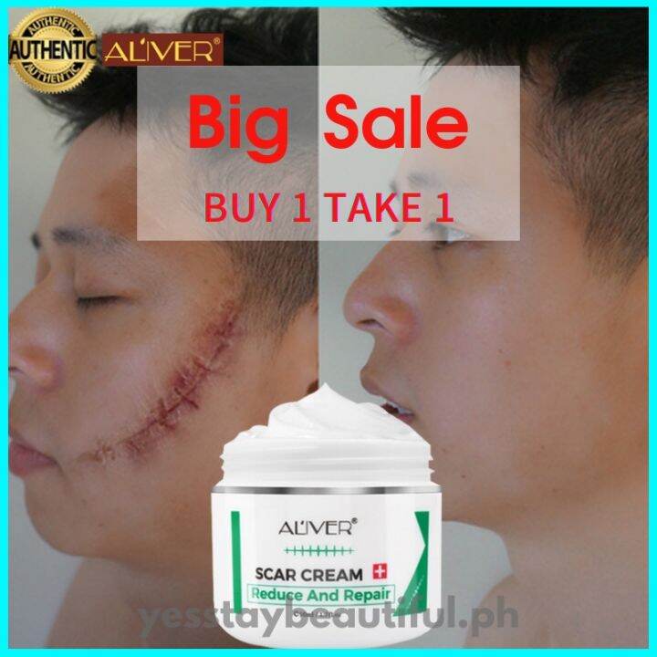 vr]Aliver Scar Removal Cream Effective Best Ever for Legs Face Old ...